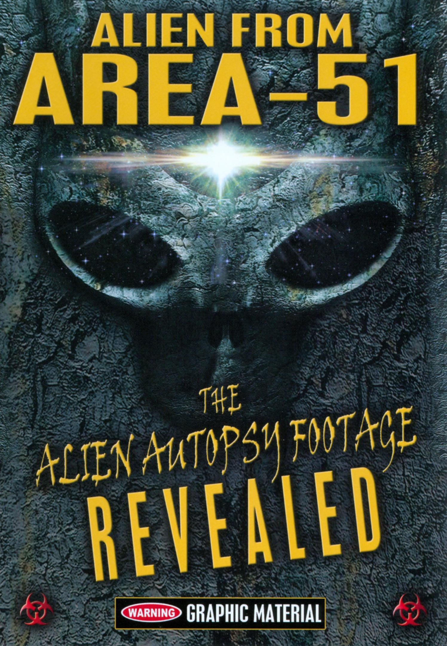 Alien From Area 51: The Alien Autopsy Footage Revealed – MovieMars